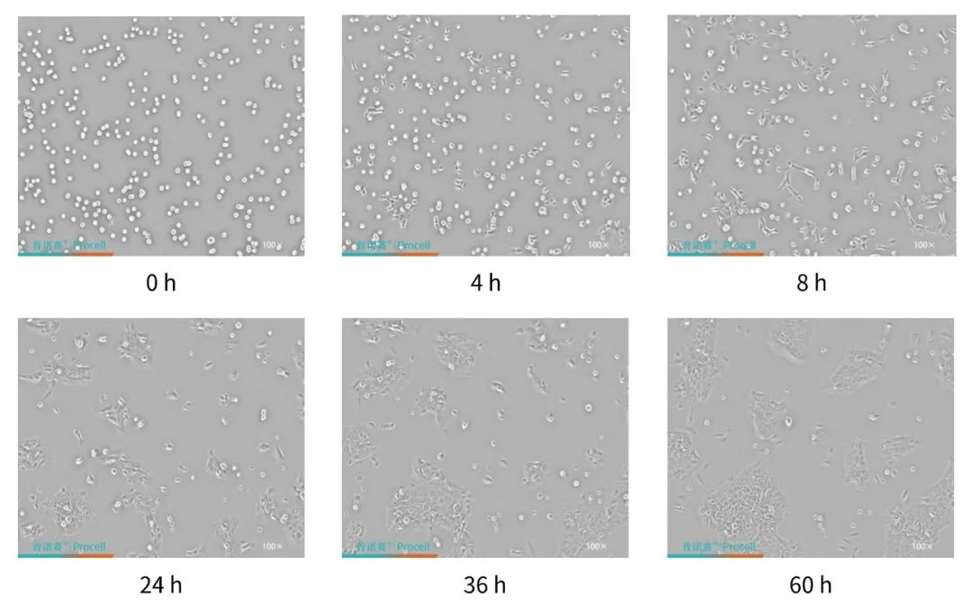 MCF 10A细胞培养攻略：从特性解析到实操小技巧-武汉普诺赛生命科技有限公司