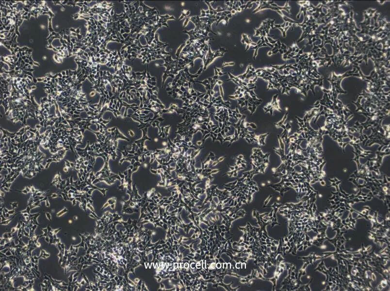 细胞学堂 | 从传代到换液，养好22RV1细胞-武汉普诺赛生命科技有限公司